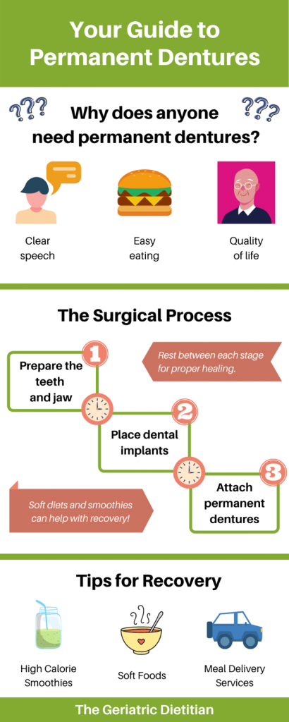 Permanent Dentures: What You Need To Know - The Geriatric Dietitian