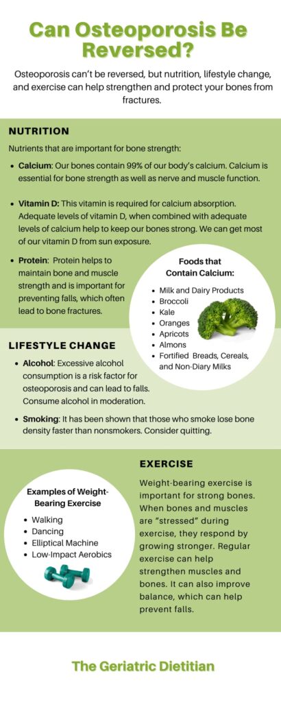 Can Osteoporosis Be Reversed? - The Geriatric Dietitian